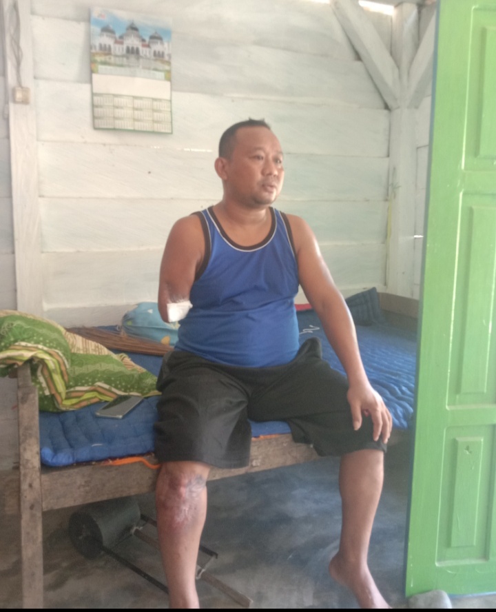 PETI Longgi Sisahkan Luka Dan Duka Bagi Syamsul Arifin Warga Taluditi – Deteksi News